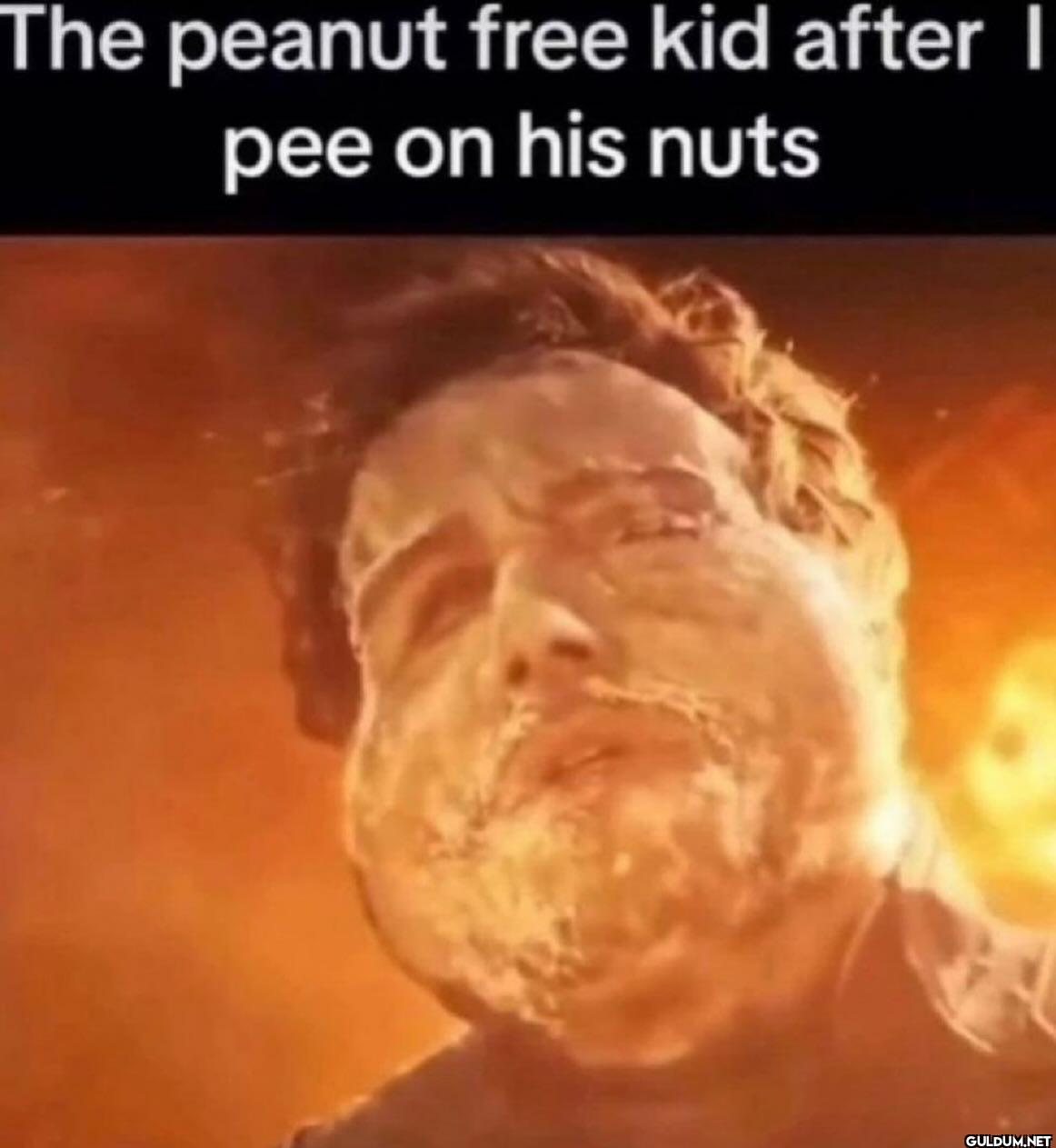 The peanut free kid after I pee on his nuts - Guldum.net - Caps arama ...