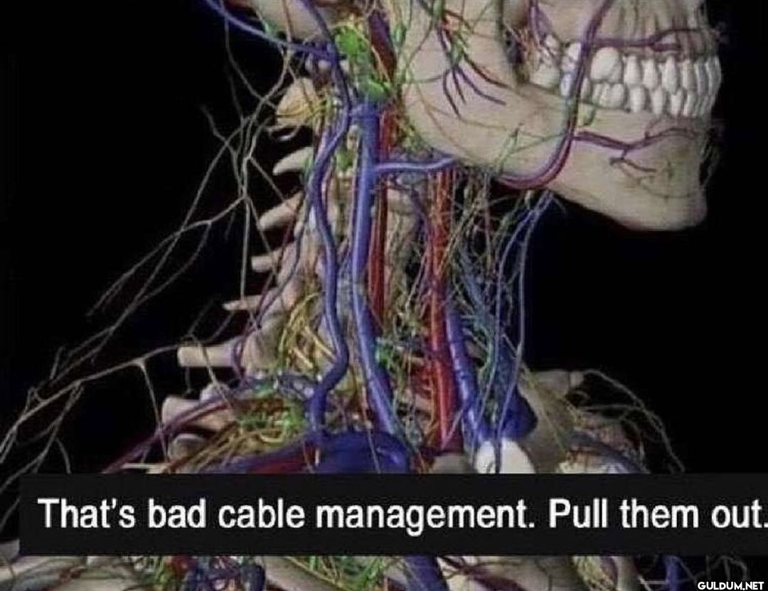 That's bad cable management. Pull them out. - Guldum.net - Caps arama ...