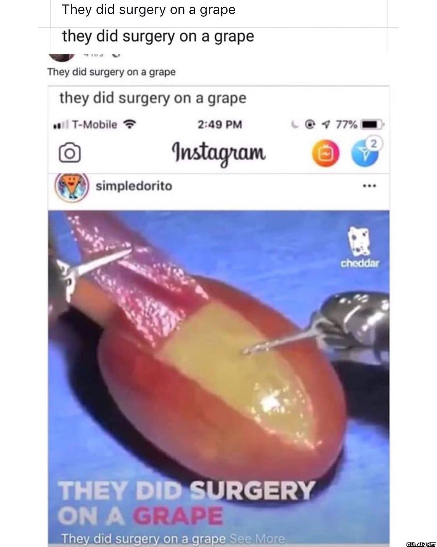 They did surgery on a grape they did surgery on a grape They did ...