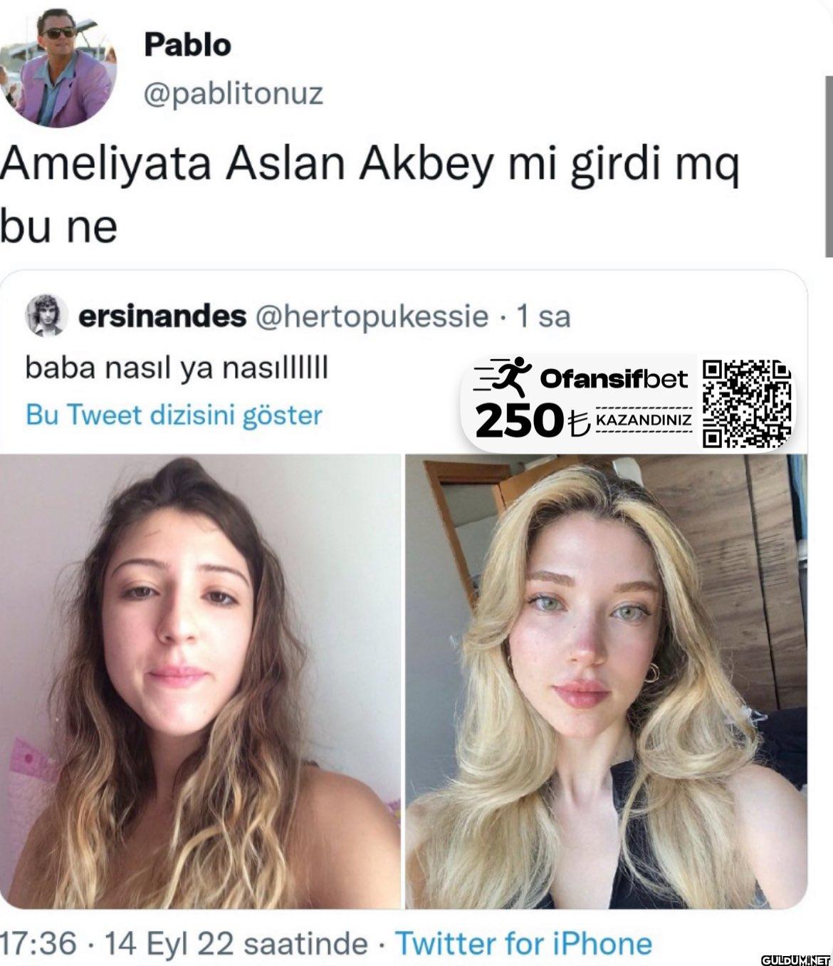 Ameliyata Aslan Akbey mi girdi mq bu ne • ersinandes @hertopukessie 1 ...