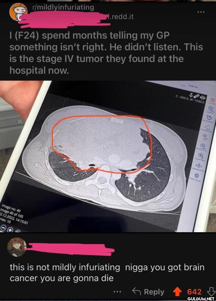 r/mildlyinfuriating .redd.it I (F24) spend months telling my GP ...